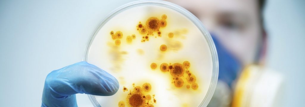 Determining immunity pathways - Fios Genomics